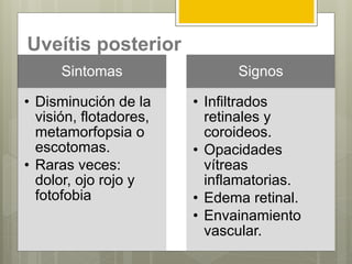 Uveitis oftalmologia | PPTX