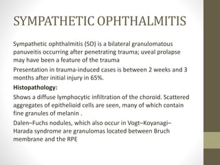 Uveitis part 2 | PPTX
