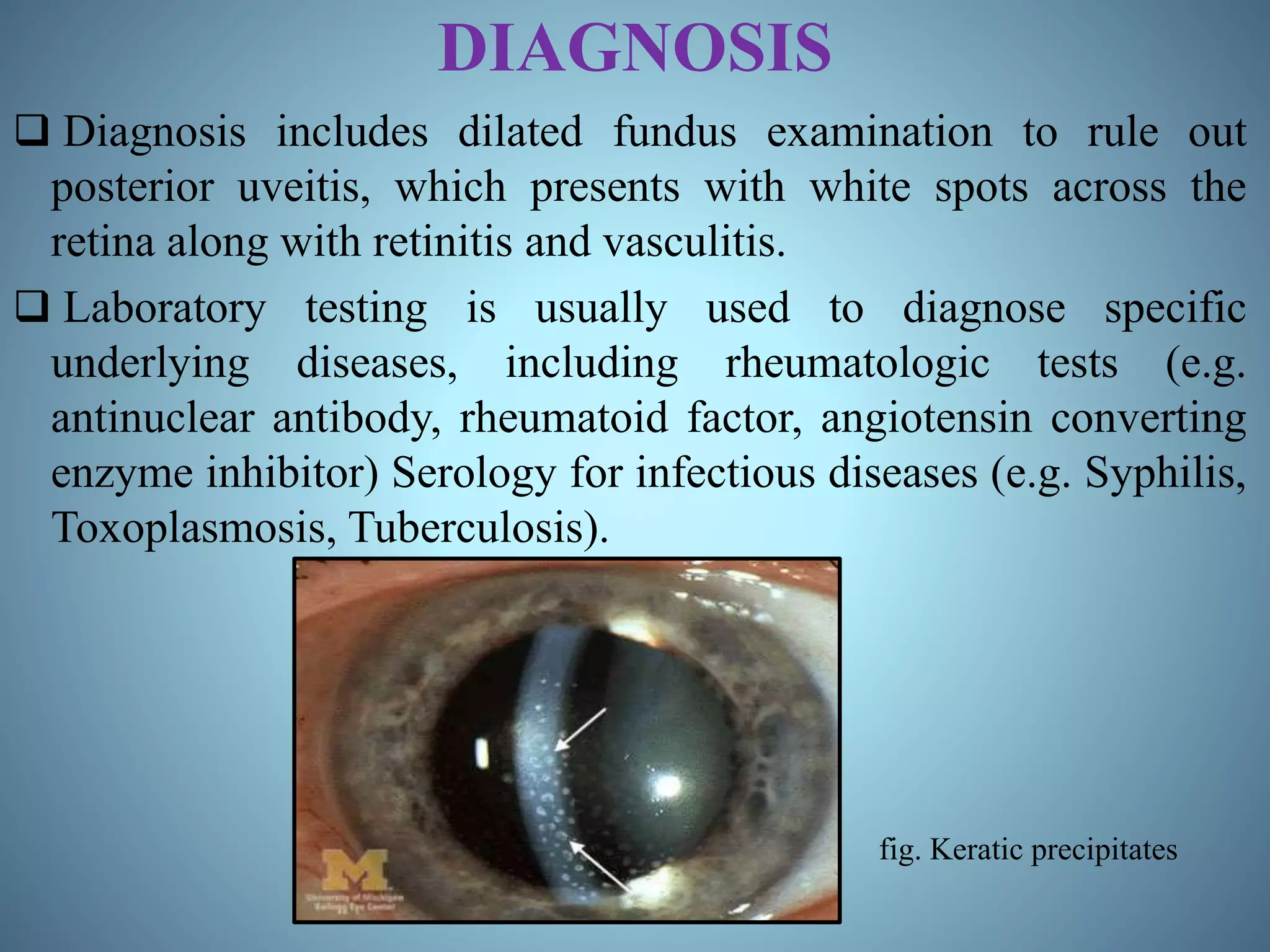 Uveitis ppt | PPTX