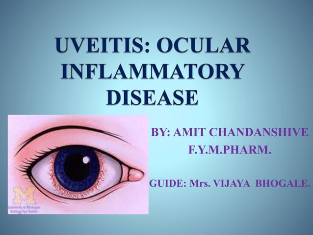 Uveitis ppt | PPTX | Eye and Vision Conditions | Diseases and Conditions