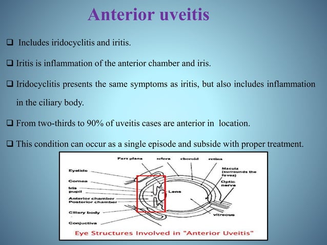 Uveitis ppt | PPTX | Eye and Vision Conditions | Diseases and Conditions