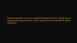 Uveitis quiz (masquerade syndrome) | PPTX