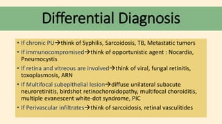 Uveitis quiz (masquerade syndrome) | PPTX