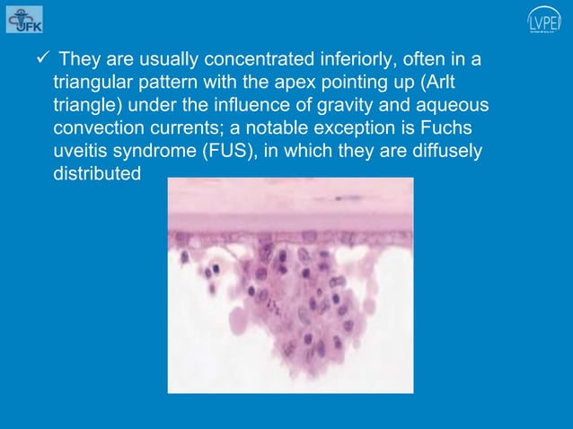 Uveitis signs and symptoms.pptx