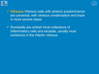 Uveitis signs and symptoms.pptx