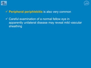 Uveitis signs and symptoms.pptx