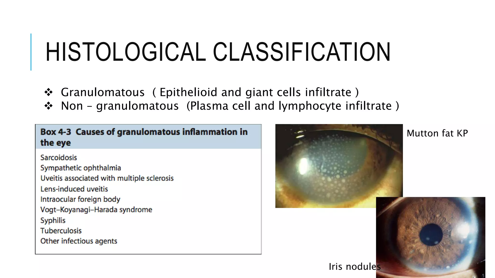Uveitits classifications and Approach | PPTX