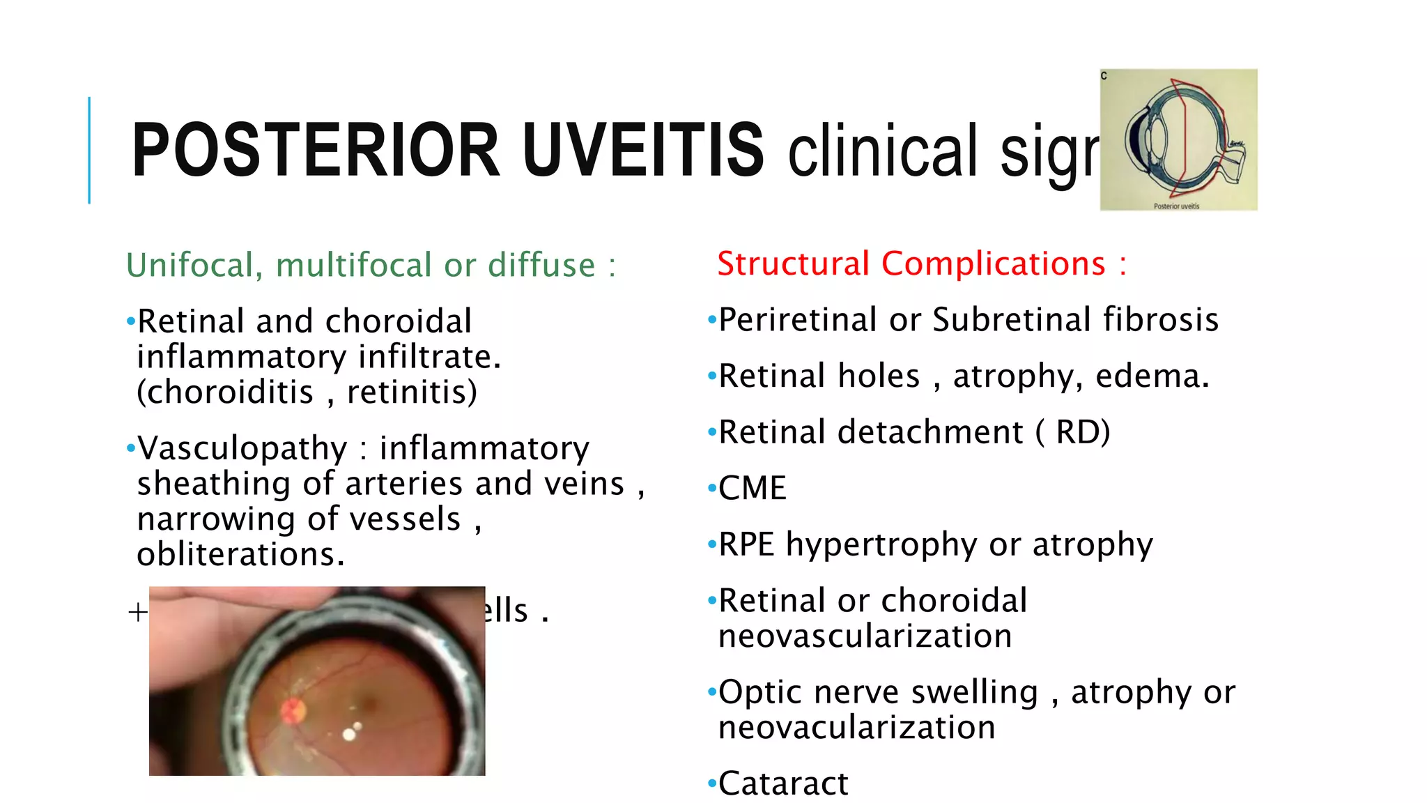 Uveitits classifications and Approach | PPTX