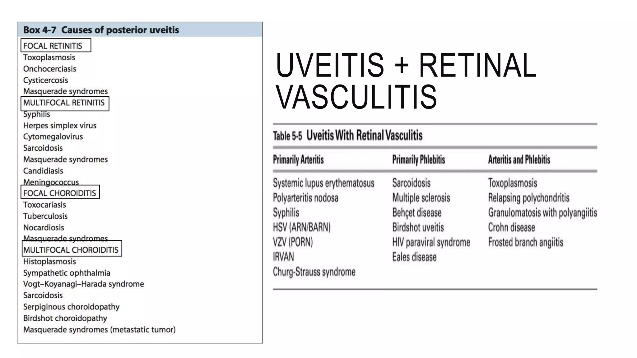 Uveitits classifications and Approach | PPTX