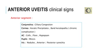Uveitits classifications and Approach | PPTX