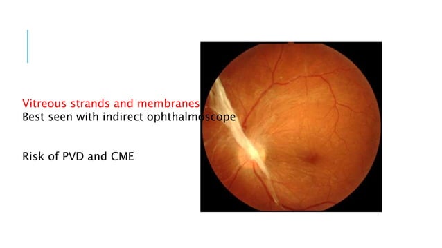 Uveitits classifications and Approach | PPTX | Eye and Vision Conditions | Diseases and Conditions