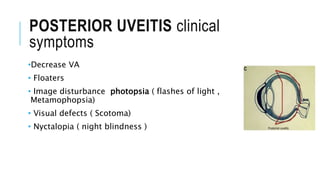 Uveitits classifications and Approach | PPTX