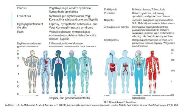 Uveitits classifications and Approach | PPTX | Eye and Vision Conditions | Diseases and Conditions