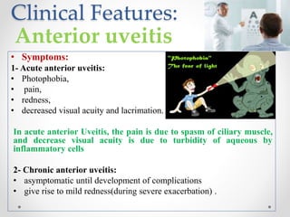 Uvitis/ opthalomology | PPT