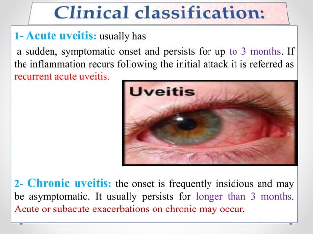Uvitis/ opthalomology | PPT