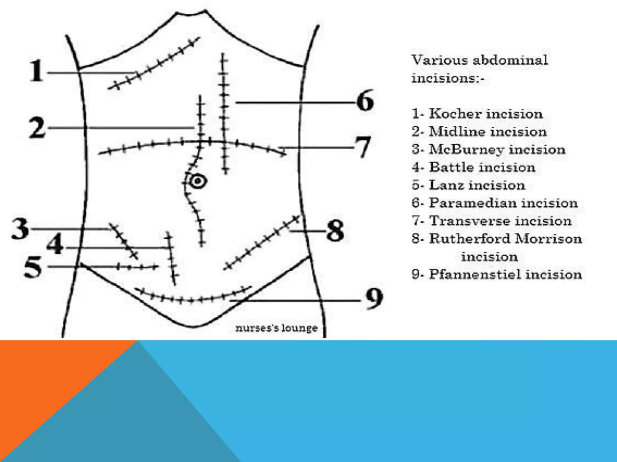 Uvod u abdominalnu kirurgiju | PPSX