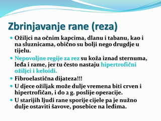 Uvod u plastičnu kirurgiju | PPSX