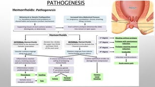 HEMORRHOIDS.pptx