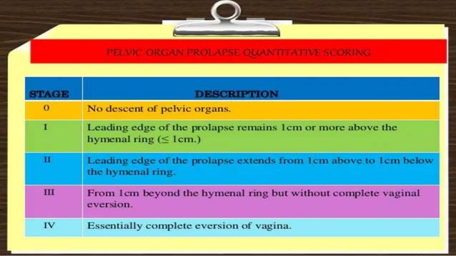 uv prolapse final.ppt