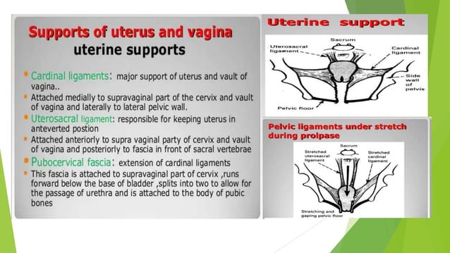 uv prolapse final.ppt