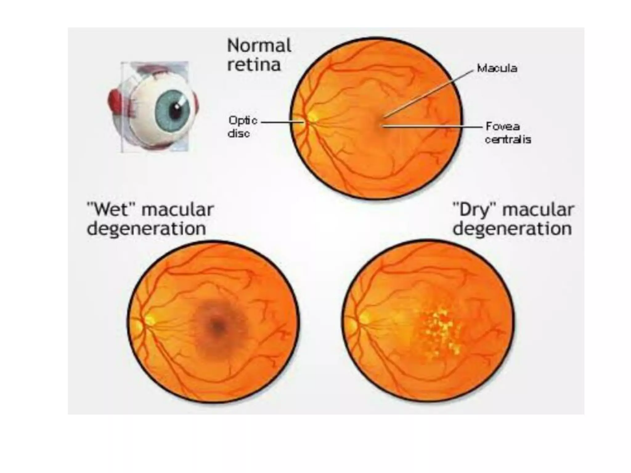 UV radiation effects on eyes | PDF