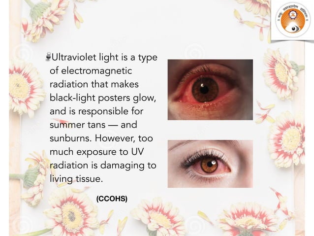 UV radiation effects on eyes | PPT