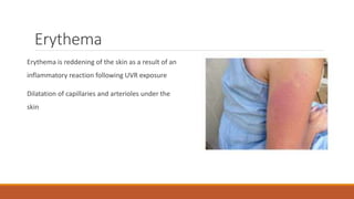 UVR Presentation.pptx