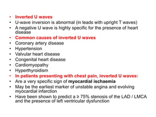 U WAVE IN ECG AND ITS ABNORMALITIES IN ECG | PPTX