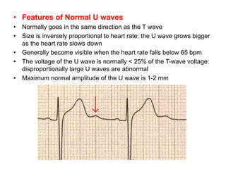 U WAVE IN ECG AND ITS ABNORMALITIES IN ECG | PPTX