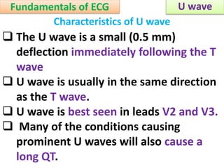Approach to a patient with U wave in ECG | PPSX