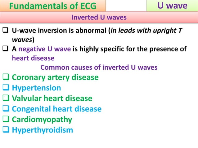 Approach to a patient with U wave in ECG | PPSX | Heart and ...