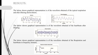 UWB radar as a life detection system | PPT