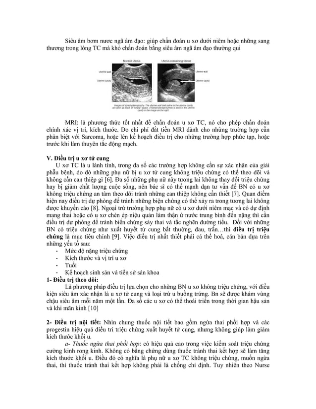 U XƠ TỬ CUNG | PDF