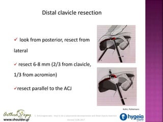 How to do a sd & a dc resection | PPT