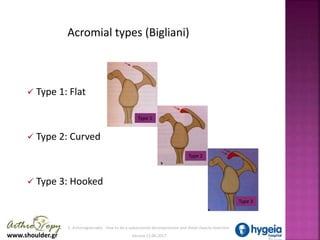 How to do a sd & a dc resection | PPT