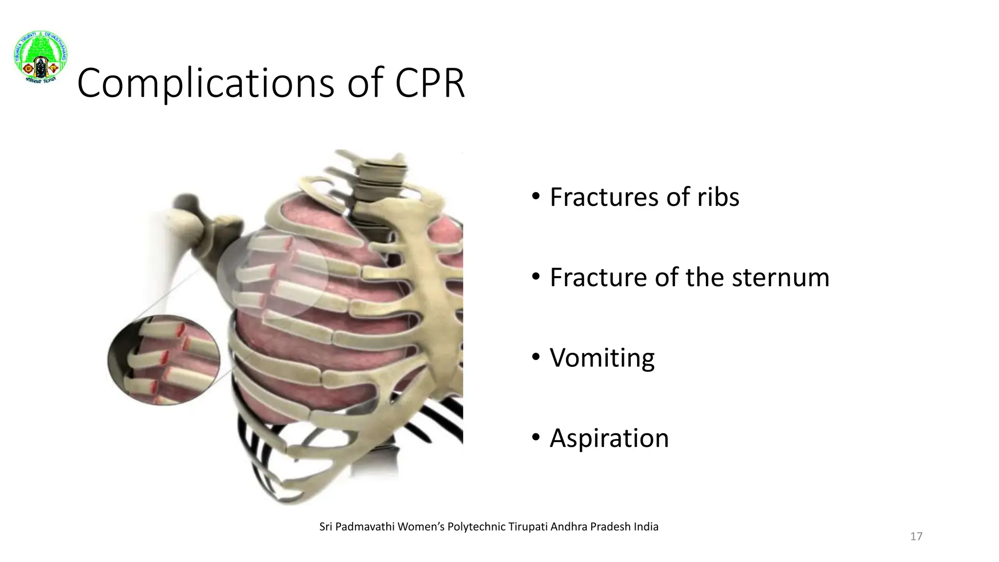 Cardio Pulmonary Resuscitation - CPR HandsTraining | PPTX