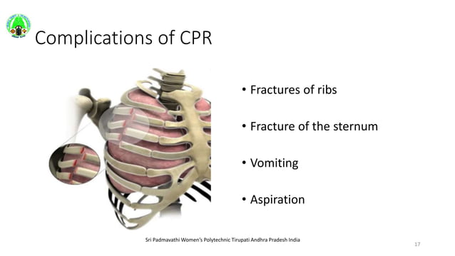 Cardio Pulmonary Resuscitation - CPR HandsTraining | PPT