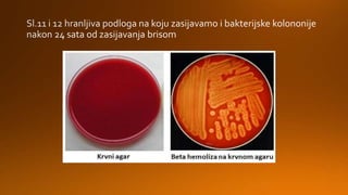 Uzimanje uzoraka sterilnim brisom | PPTX