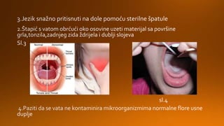 Uzimanje uzoraka sterilnim brisom | PPTX