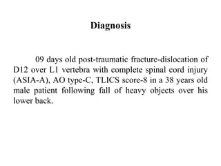 V-1 #dislocation D12 over L1 Dr Delower Hossain.pptx