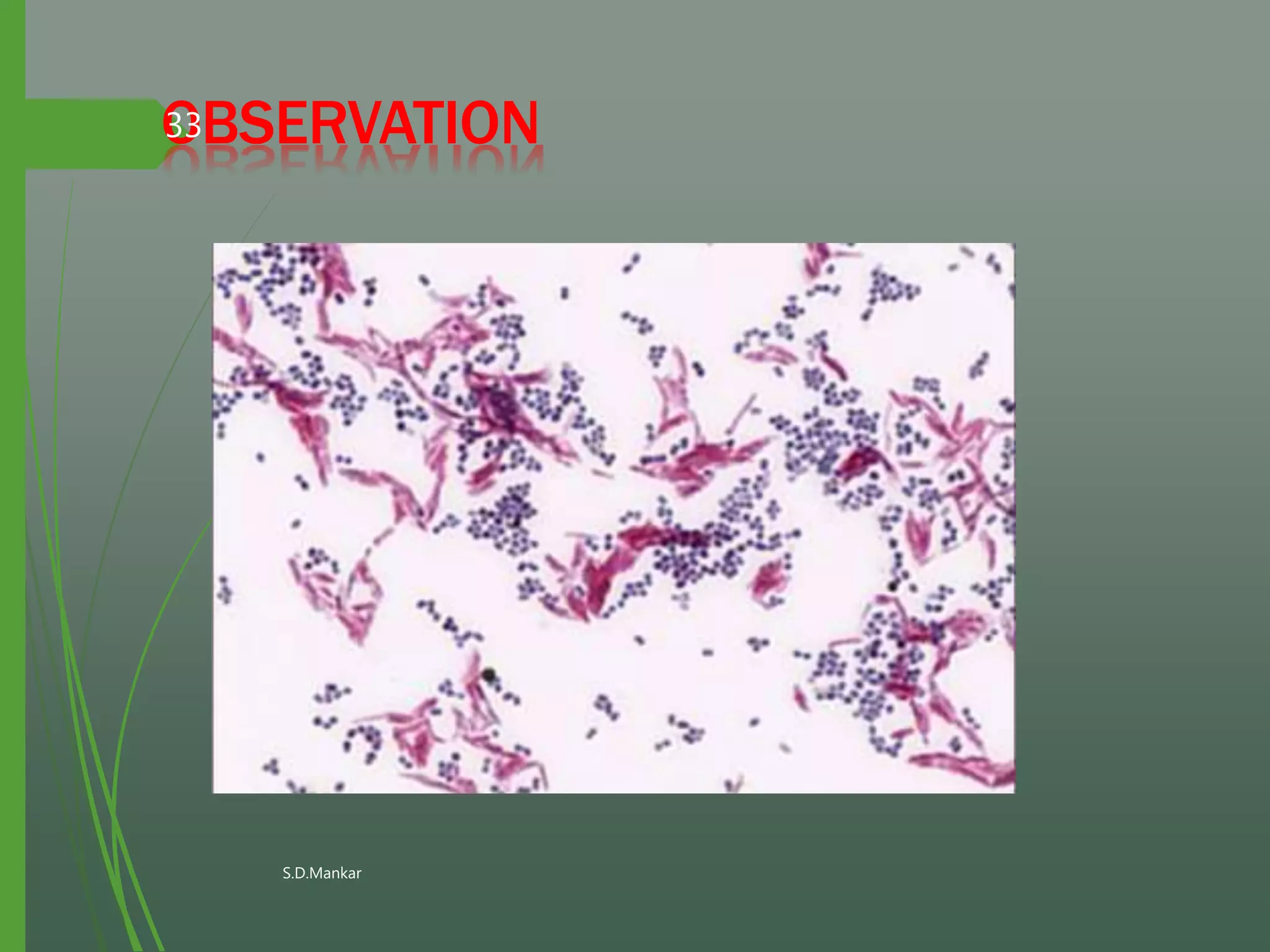 Identification of bacteria by using different staining techniques like simple staining, grams's ...