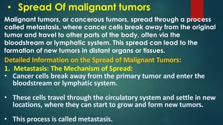 TUMORS and Types of tumors, General biology of tumors, Spread of ...