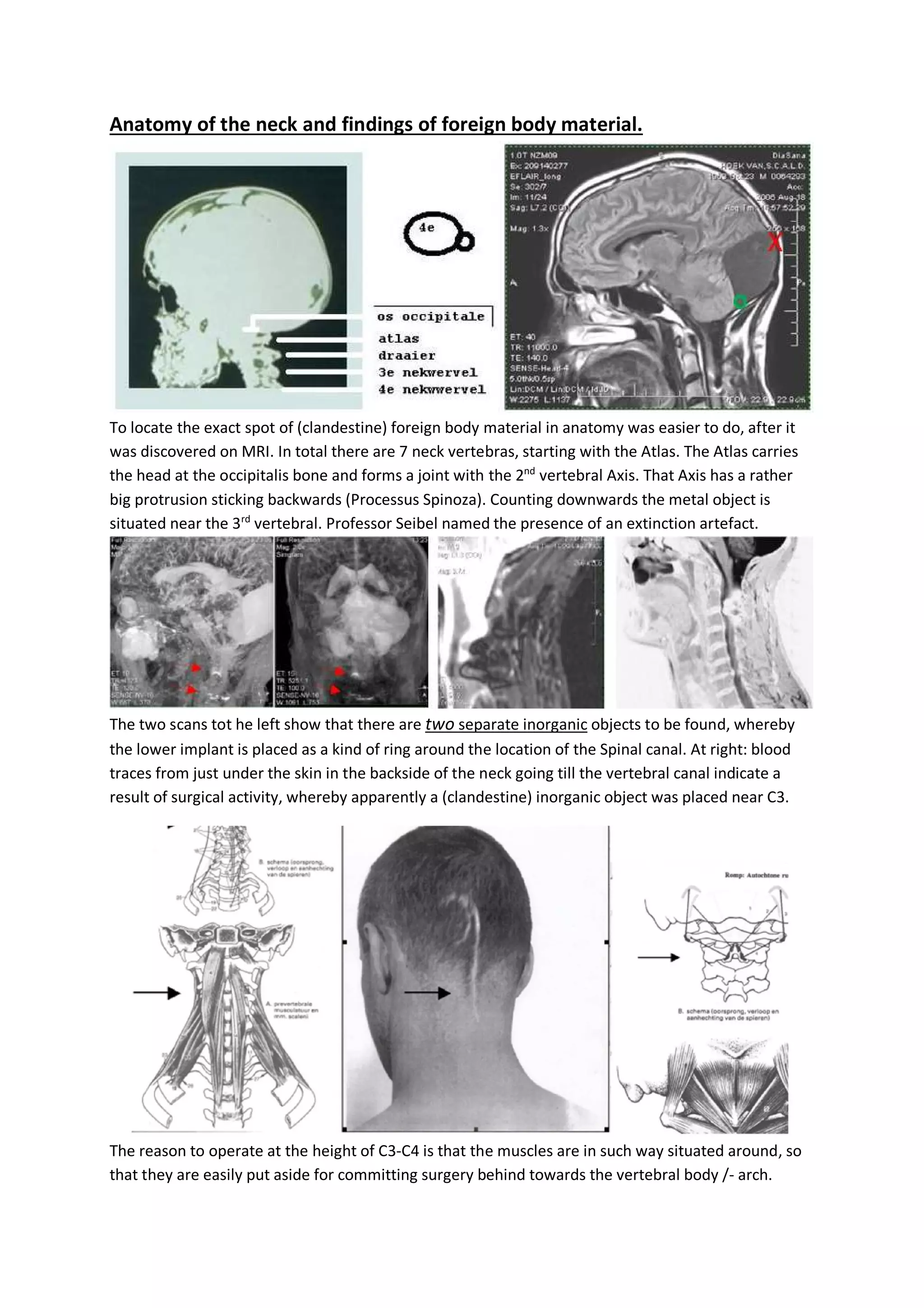 V introduction anatomy head and neck for background info | PDF