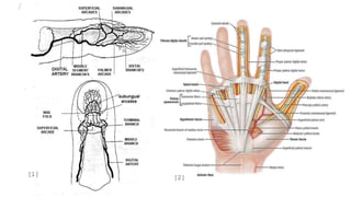 V-Y Advancement flap - for Fingertip amputations | PPTX
