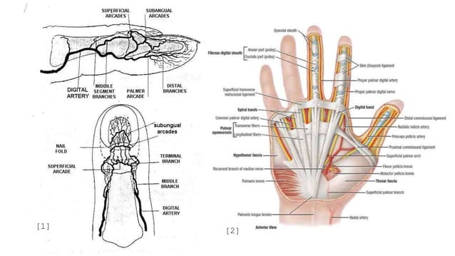 V-Y Advancement flap - for Fingertip amputations | PPTX | Death, Injury ...