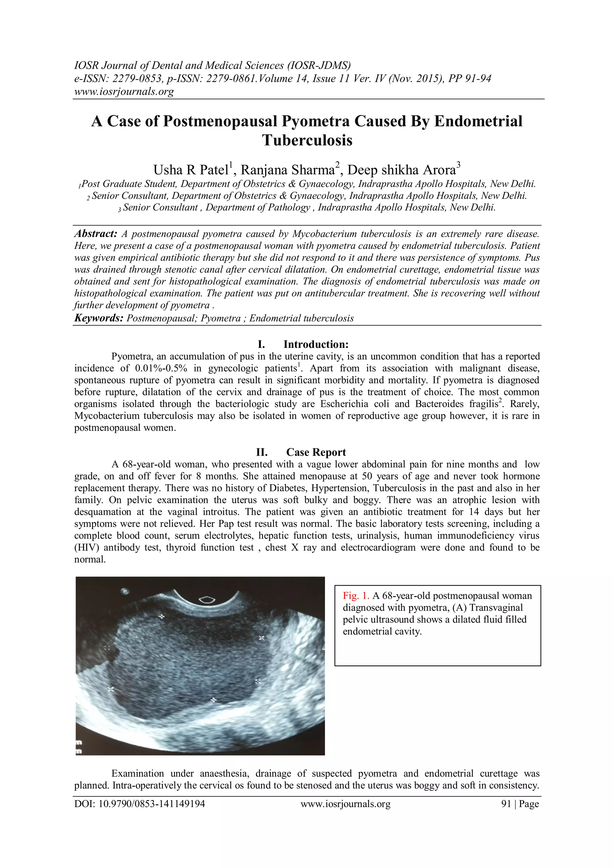A Case of Postmenopausal Pyometra Caused By Endometrial Tuberculosis ...