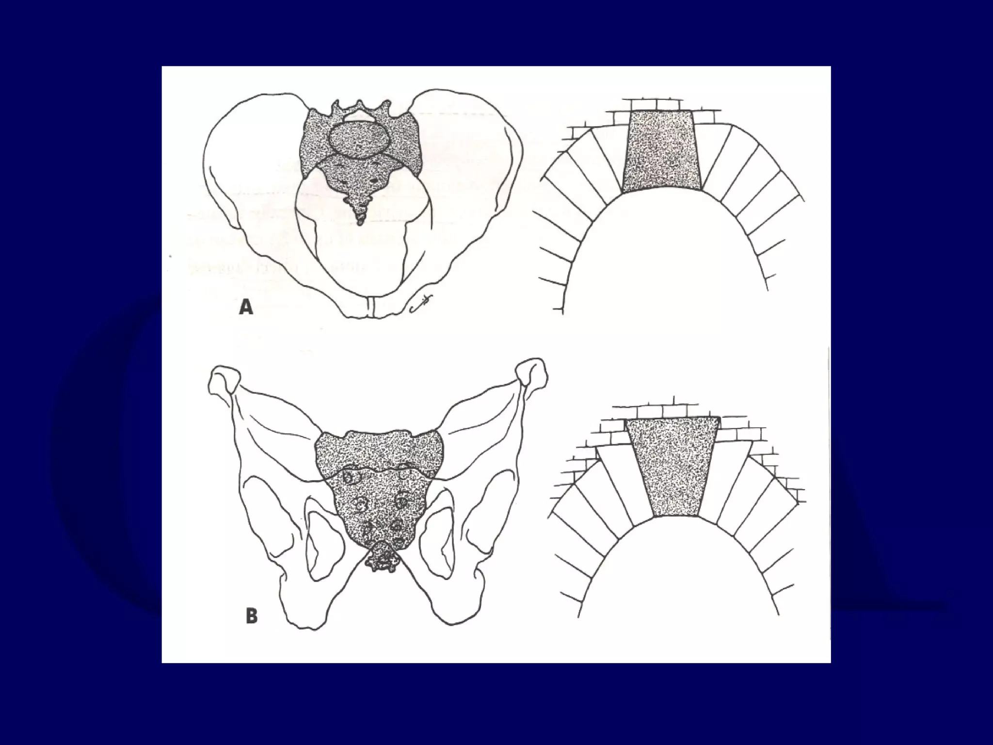 V01 anatomy class_pelvis | PPT