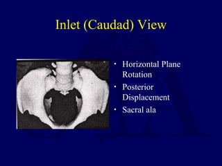 V01 anatomy class_pelvis | PPT