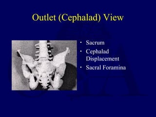 V01 anatomy class_pelvis | PPT