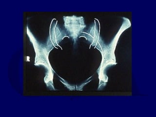 V01 anatomy class_pelvis | PPT
